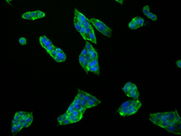 INS-1E Rat Insulinoma Beta Cell Line | SCC491